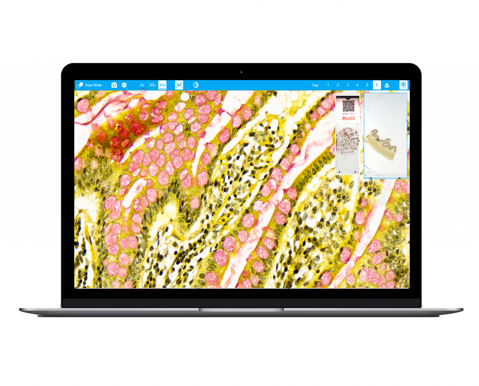 FS-Live Telepathology System - Motic Digital Pathology