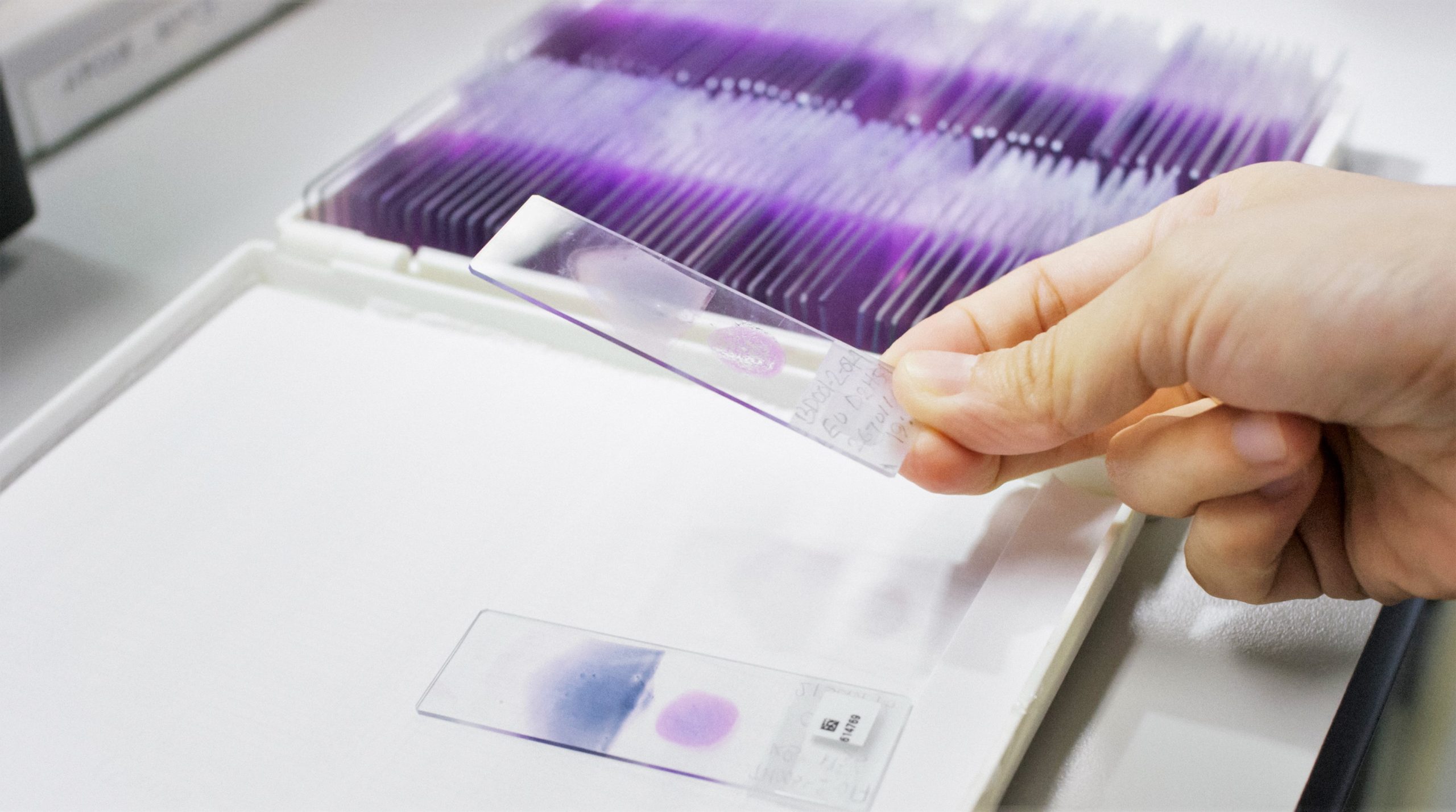 Field Evaluation of the EasyScan GO: Digital Malaria Microscopy Device