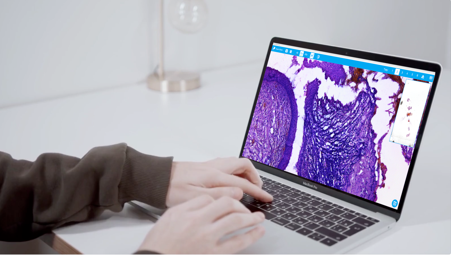 Webinars - Motic Digital Pathology