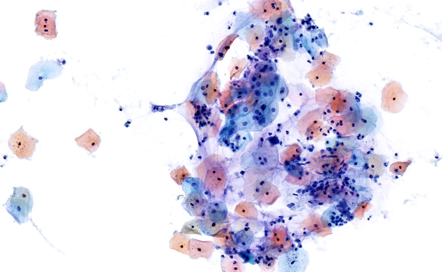Remote Frozen Sections - Motic Digital Pathology