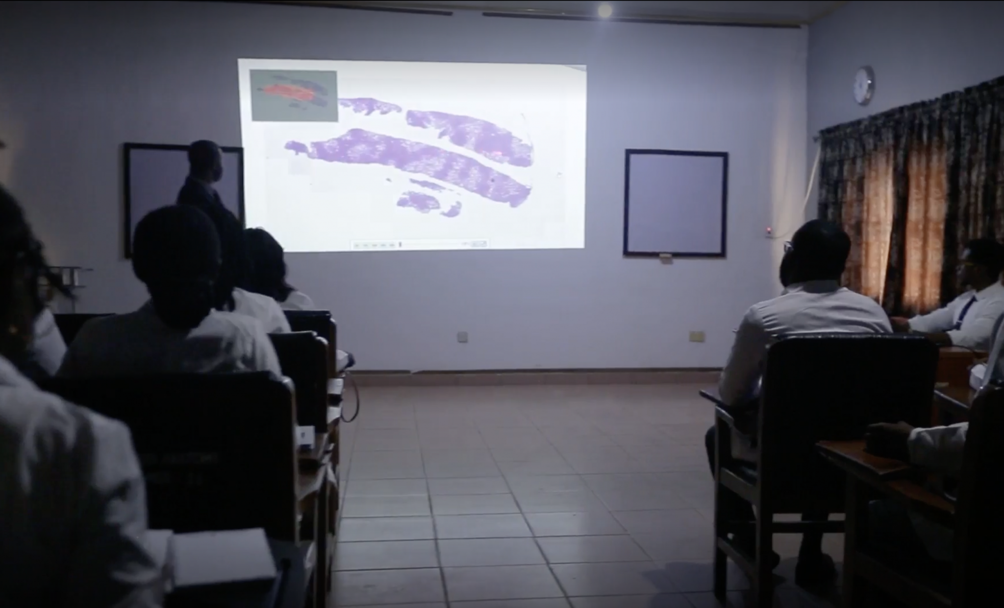 Digital Pathology in Nigeria: From Clinical Diagnosis to Pathology ...