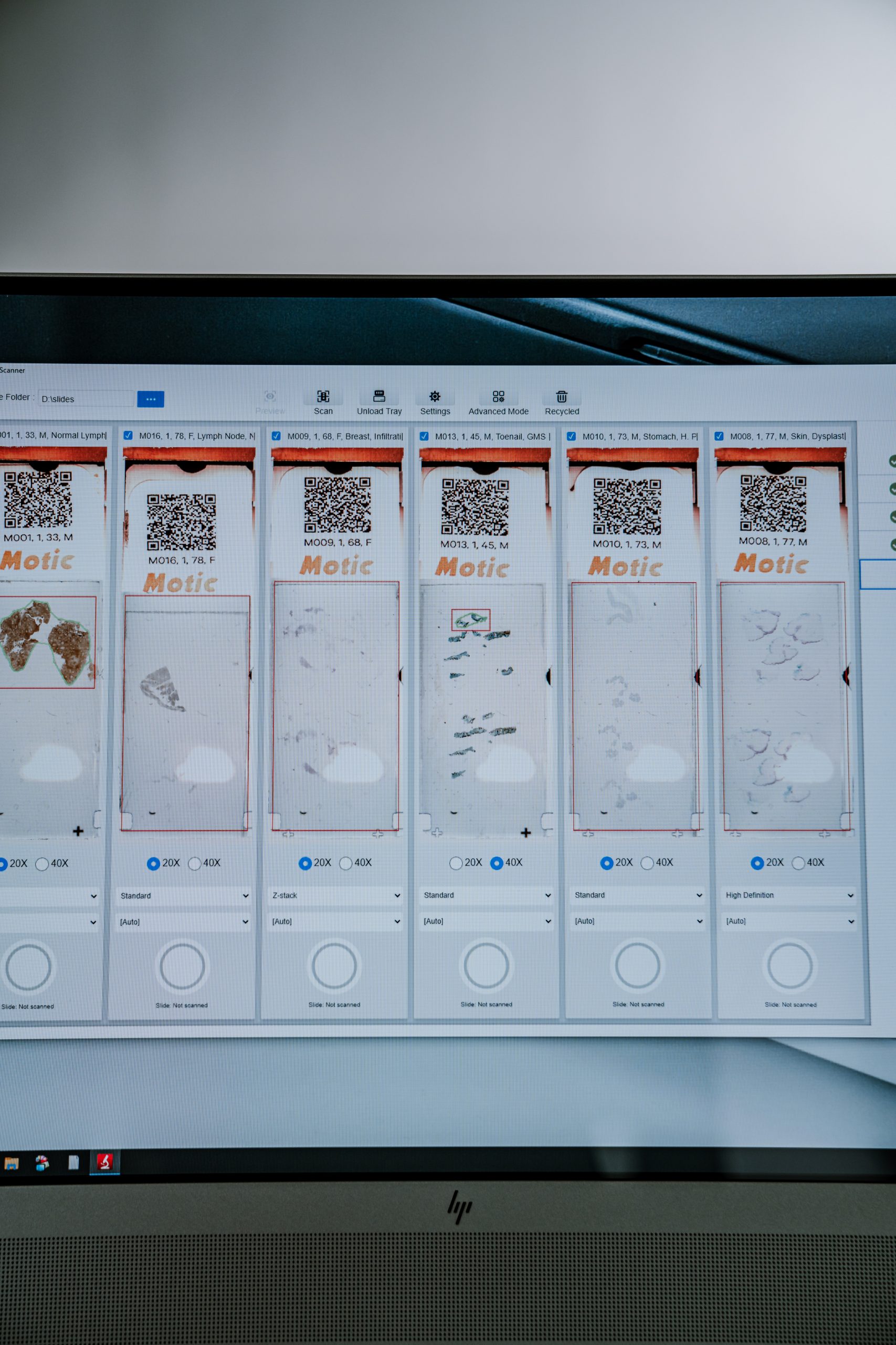 WSI & Digital Pathology Lab Equipment: A Comprehensive Guide - Motic ...