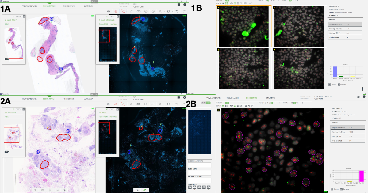 Improving interoperability in digital HER2 FISH enumeration a pilot ...