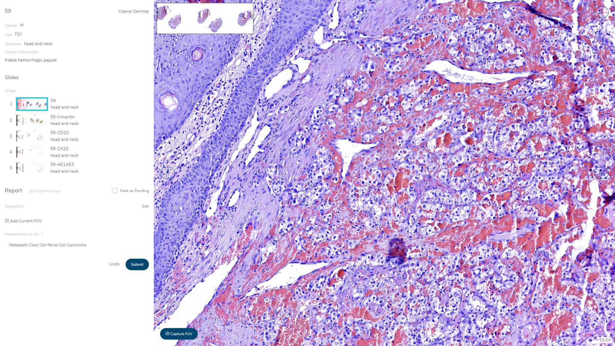 Real-Time Telepathology Software Comparison - Motic Digital Pathology
