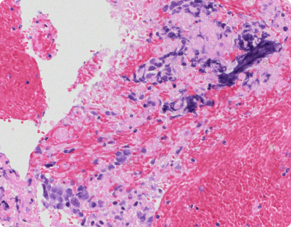 Fluorescence Whole Slide Imaging Scanner - Motic Digital Pathology
